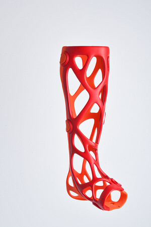 엑스퍼트코리아, 영국 Xkelet과 골절환자 맞춤형 의료기기 ‘엑스 스프린트 에어’ 공동개발 협약